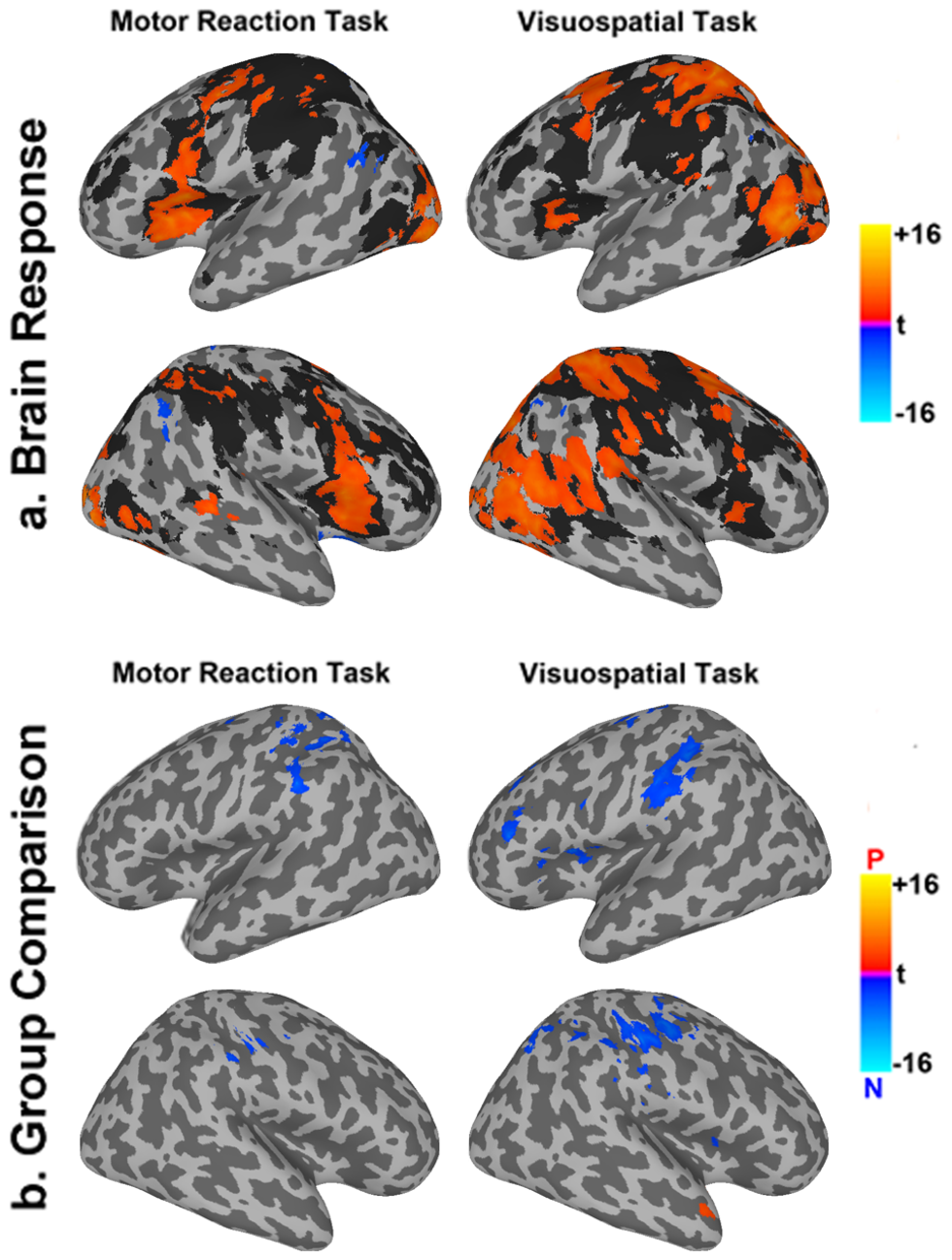 Brain Fitness: Less Stress, Better Sleep, More Focus – FocusCalm
